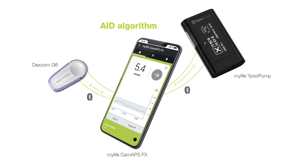 Hybrid closed loop research | Breakthrough T1D UK