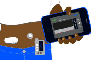 Hybrid closed loop technology (artificial pancreas) | Breakthrough T1D UK