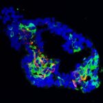 Barbie with type 1 diabetes doll from Breakthrough T1D and Mattel